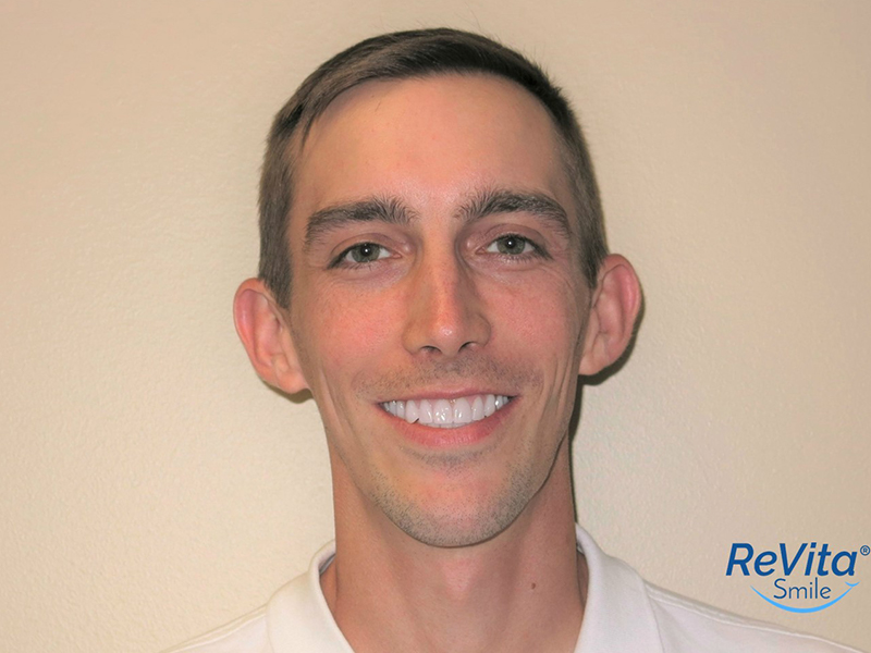 All-on-4® Full Arch Dental Implant | North Shore Smile Surgery